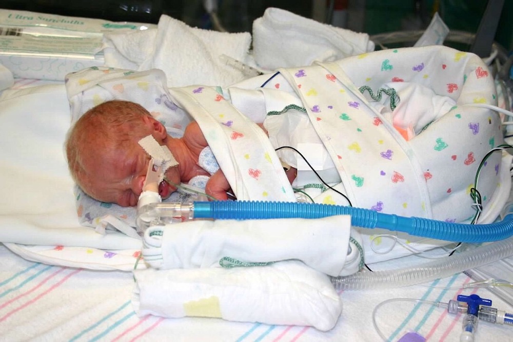 Whit's story: Beating the odds | Texas Children's